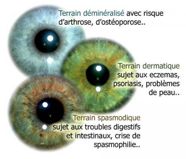 Iridologie – Medecinedouce-jura.com